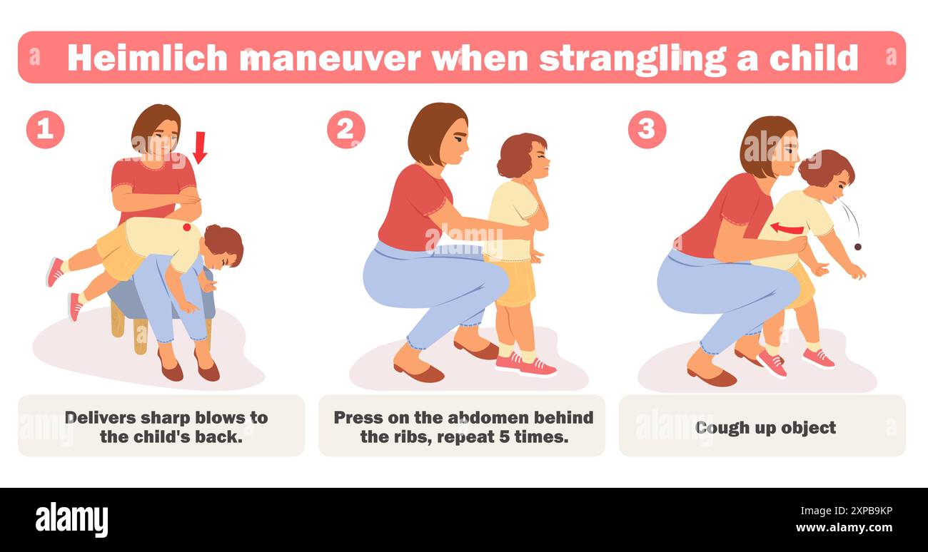 Child help with choking infographic poster vector illustration Stock ...
