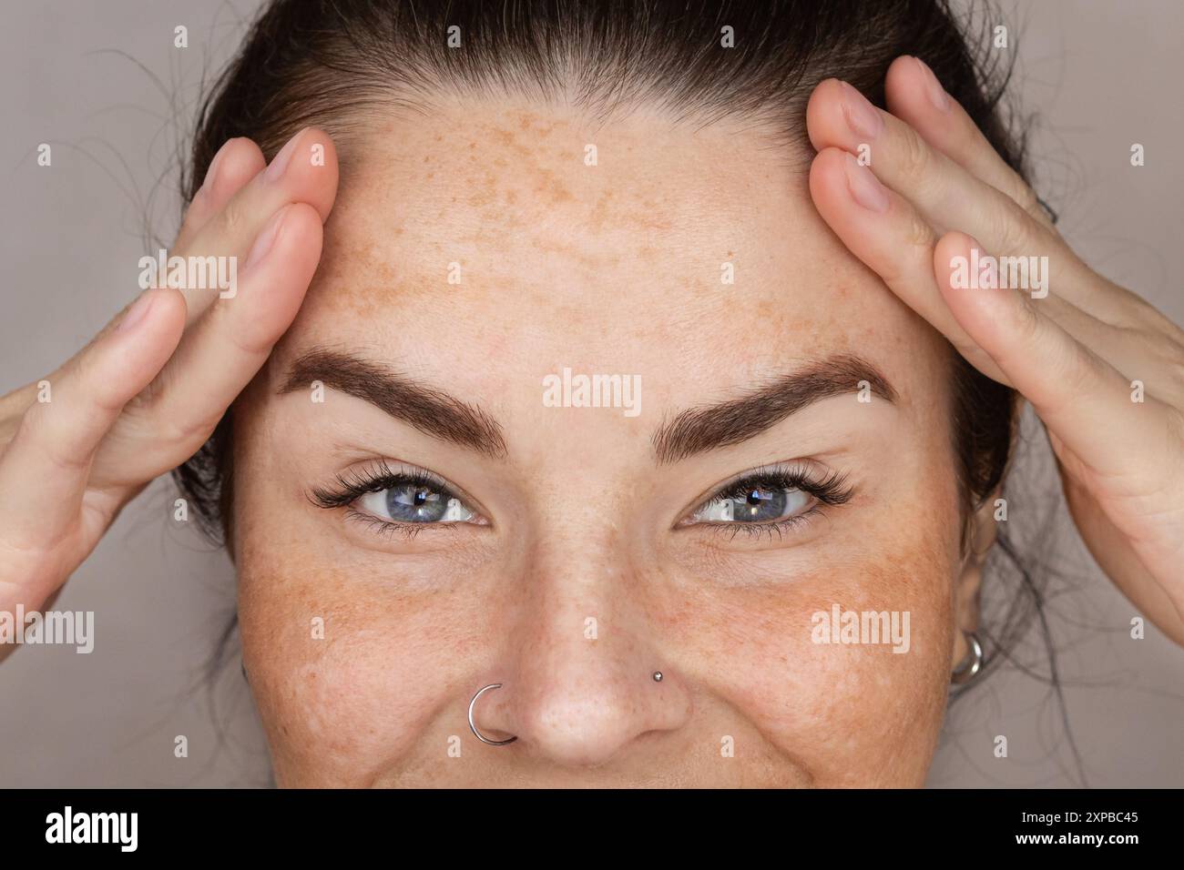 Sun spots face hi-res stock photography and images - Alamy