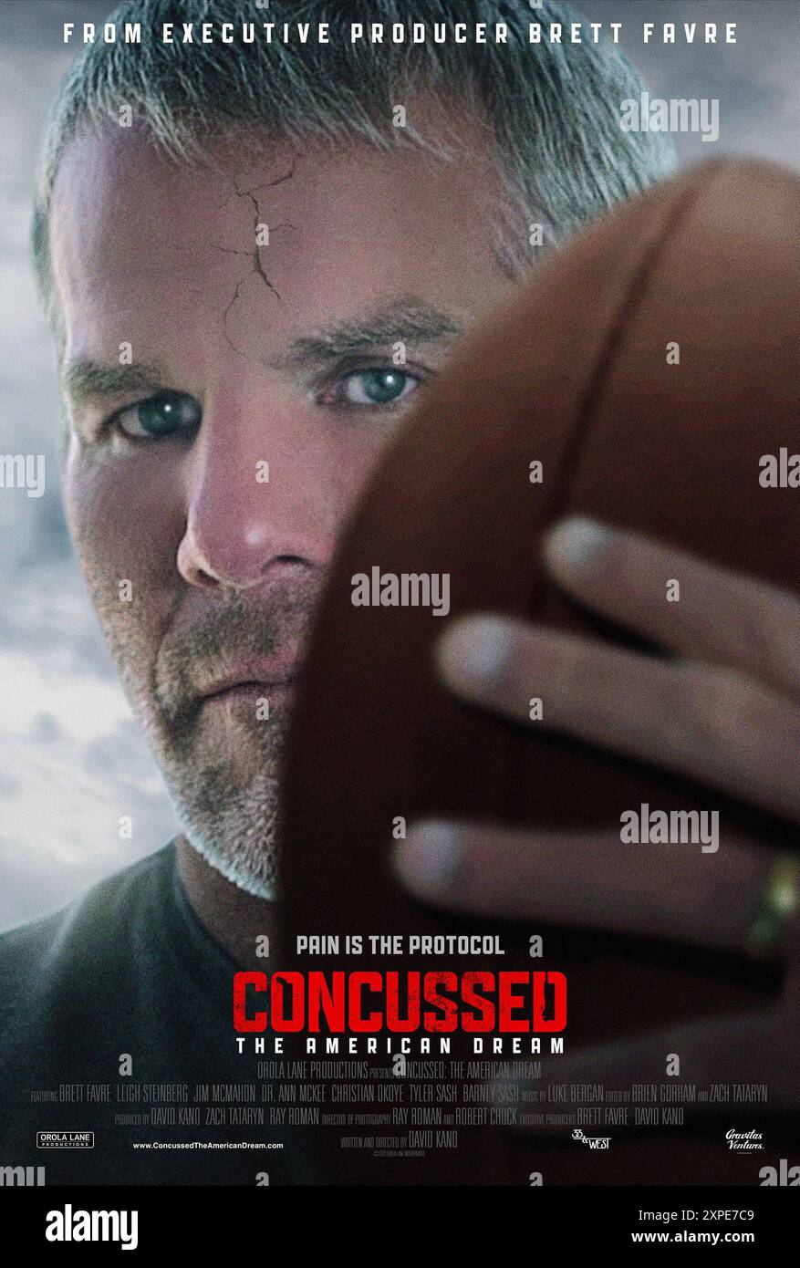 CONCUSSED: THE AMERICAN DREAM, US poster, Tyler Sash, 2024. © Gravitas ...