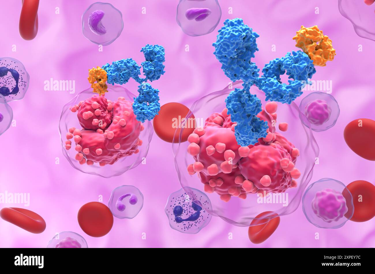 Monoclonal antibody therapy in Acute Lymphocytic Leukemia (ALL ...