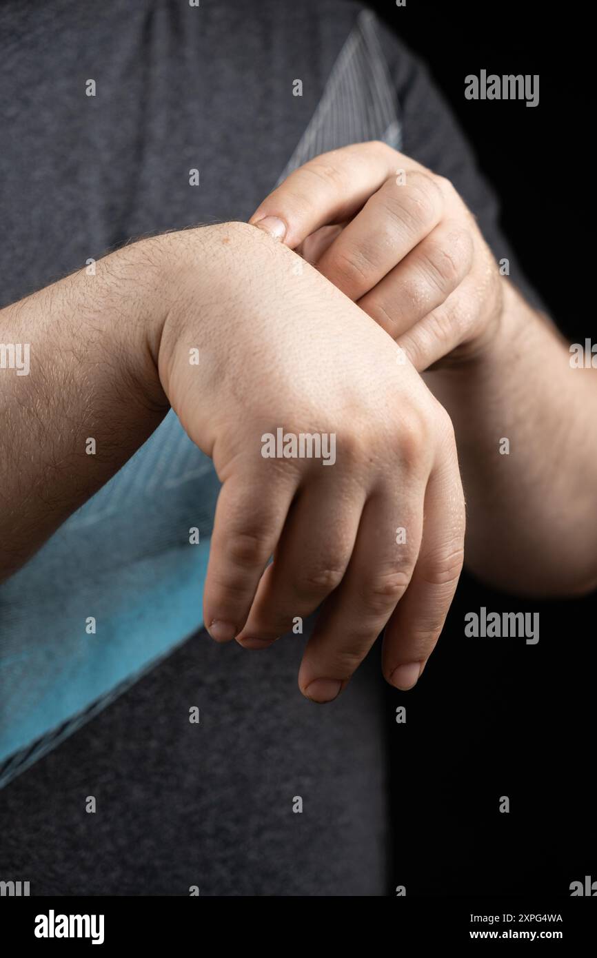 A male patient shows a ganglion cyst on his wrist Stock Photo - Alamy