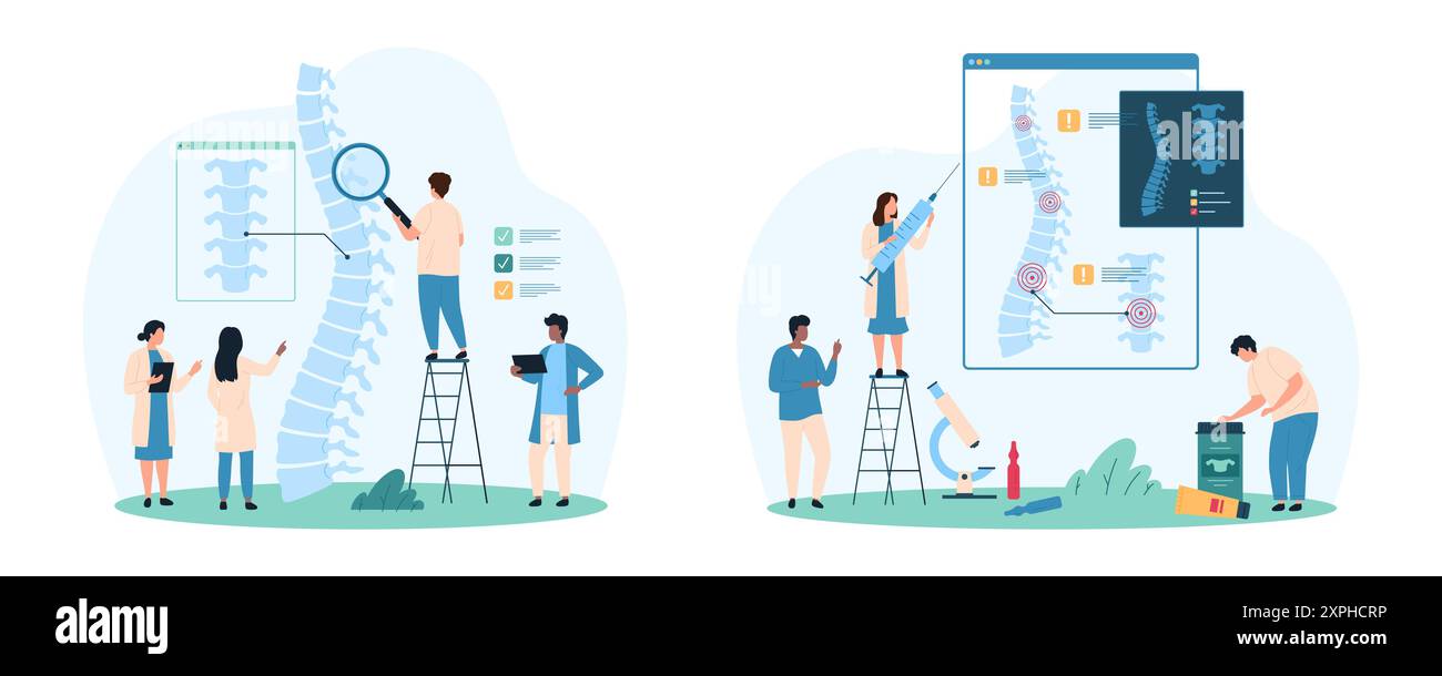 Diagnosis and treatment of spinal column diseases. set. Tiny people ...