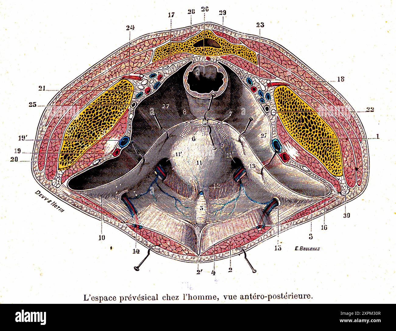 Illustration of the anatomy of the male pelvis. The bladder is at ...