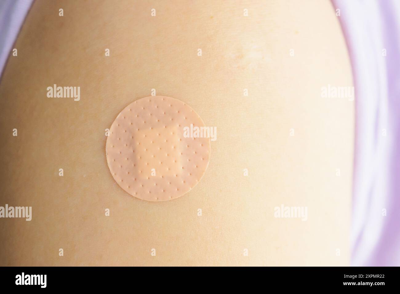 Close up circle brown adhesive bandage on patient arm after medicine ...