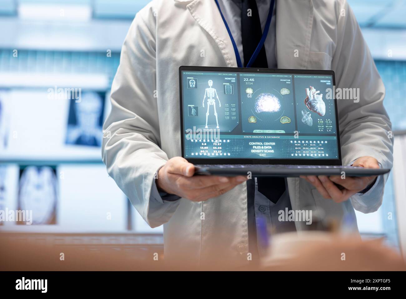 Physician presenting a ct scan result for heart and brain analytics ...