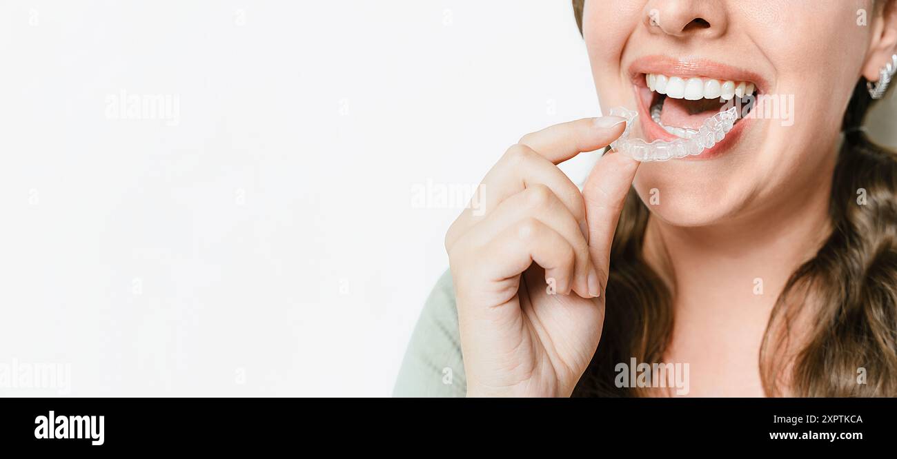 A smiling woman inserts a clear teeth aligner, straightening teeth ...