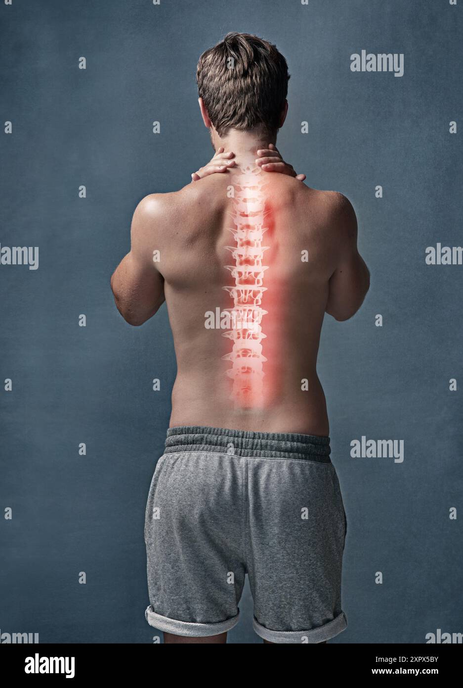 Man, back and neck pain with xray of spine, red glow or inflammation on ...