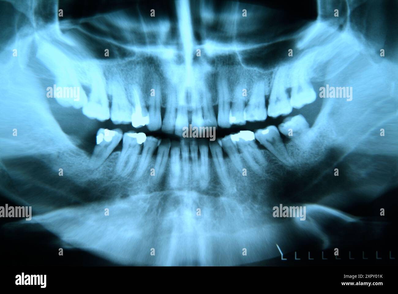 Dentistry plate hi-res stock photography and images - Alamy