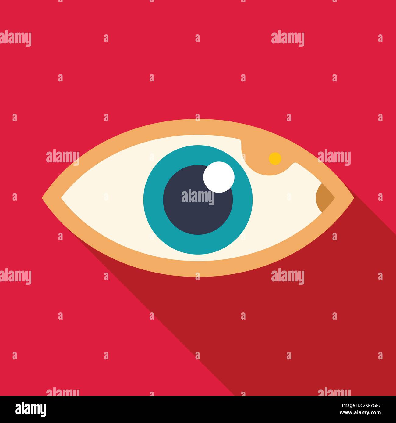 Human eye with yellow discoloration, a sign of jaundice, depicted in a ...