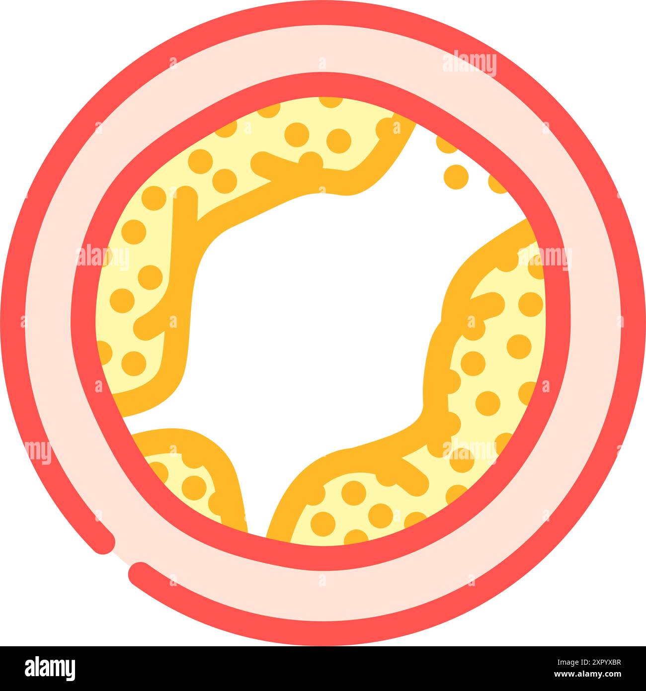 high cholesterol obesity overweight color icon vector illustration ...