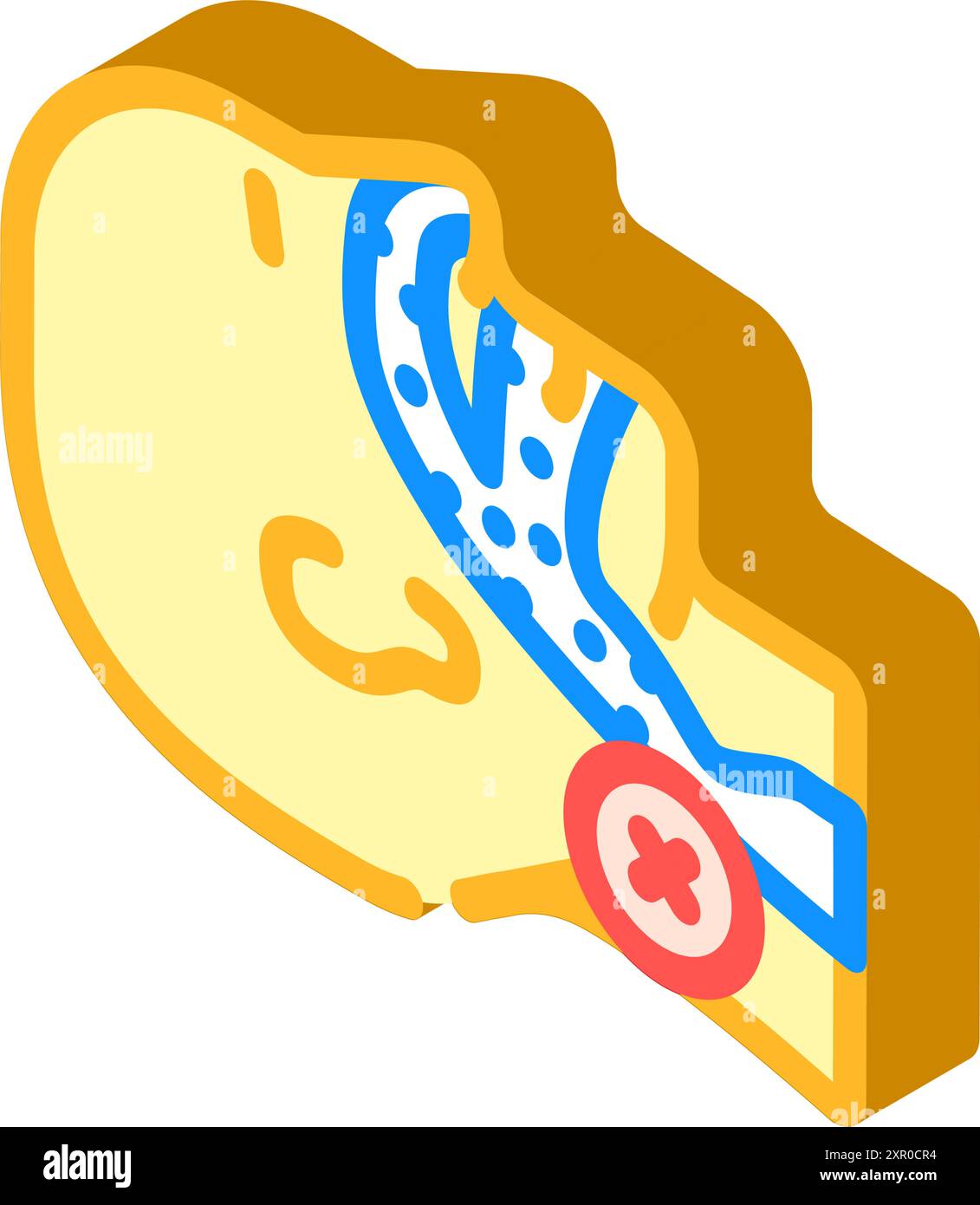 obstructive sleep apnea obesity overweight isometric icon vector ...