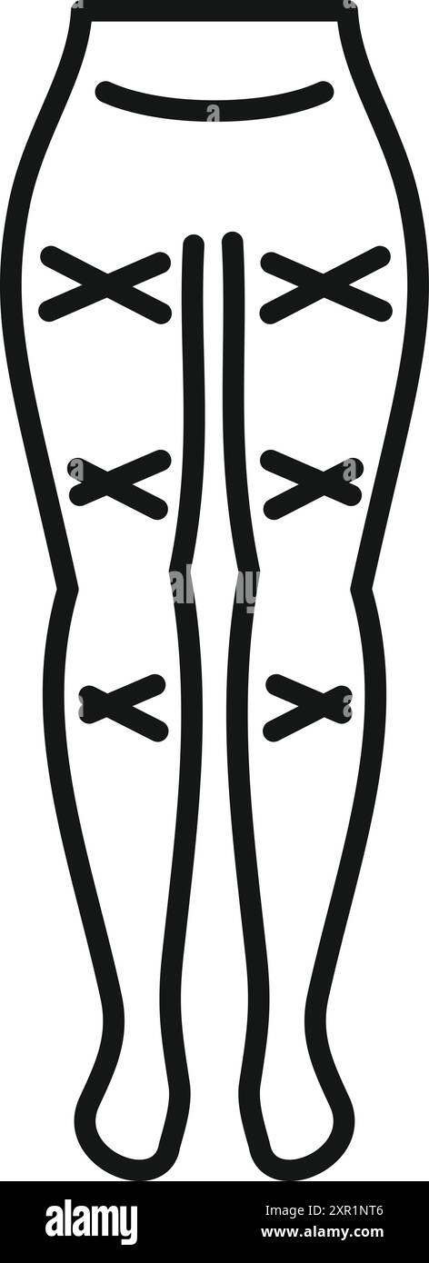 Woman legs with compression stockings are showing varicose veins ...