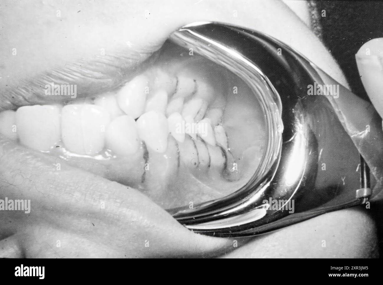 Photos of mouths and teeth, 05-03-1965, Whizgle Dutch News: Historic ...