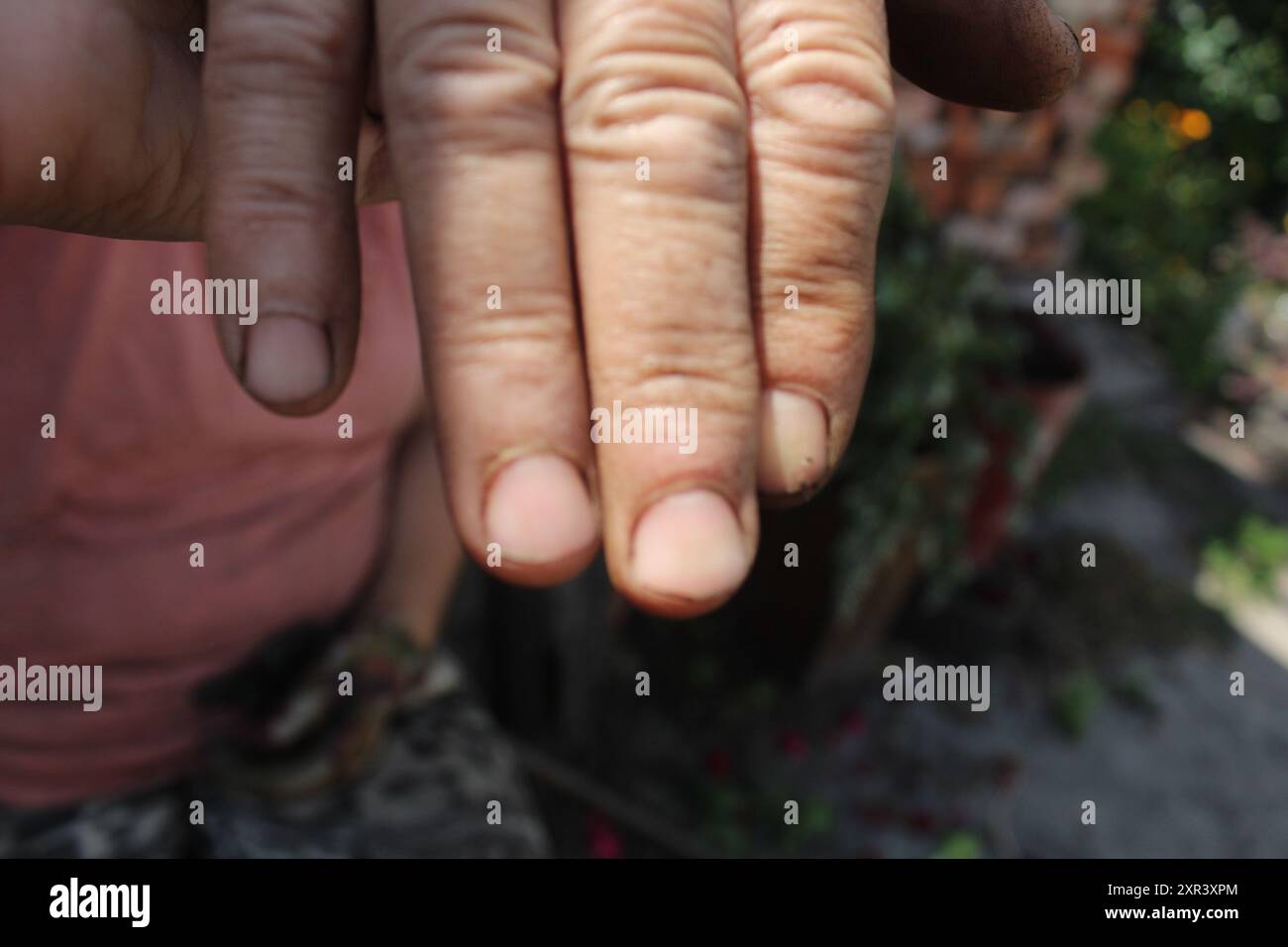 Dirty fingernails hi-res stock photography and images - Alamy