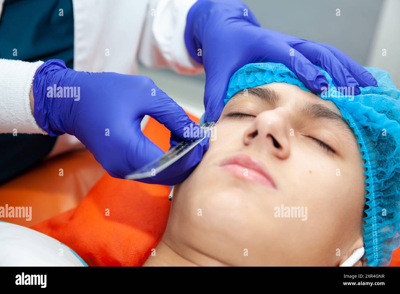 Skin lesion removal procedure. Dermatologist carrying out a removal of ...