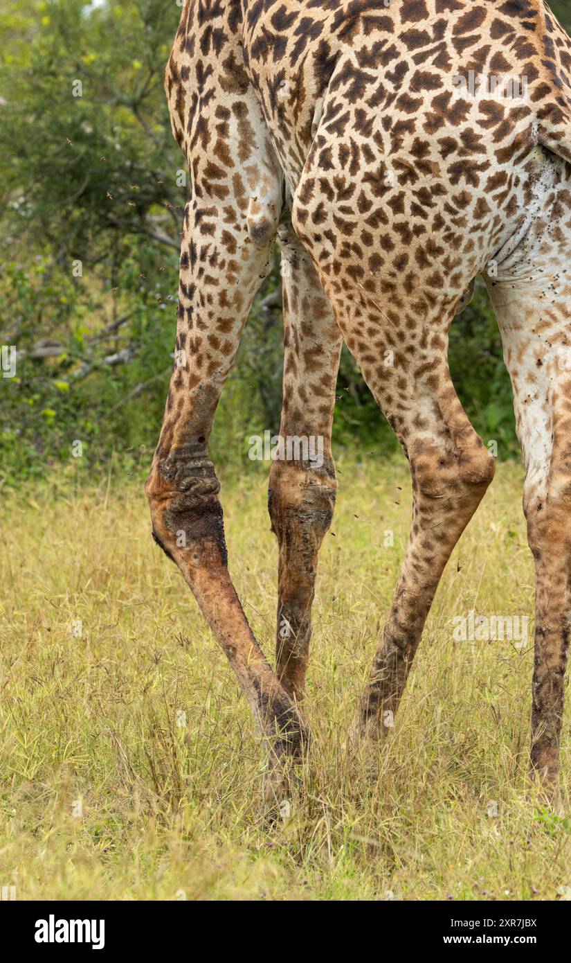 Pressure sores hi-res stock photography and images - Alamy