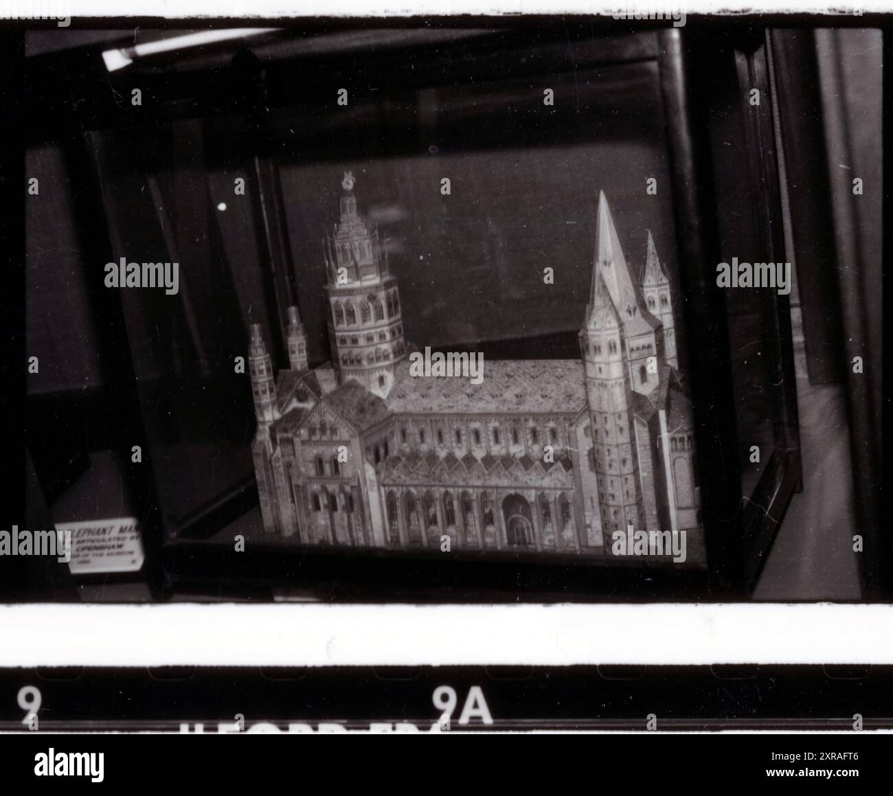 Joseph 'John' Carey Merrick (1862-90) - aka The Elephant Man. Pathology ...