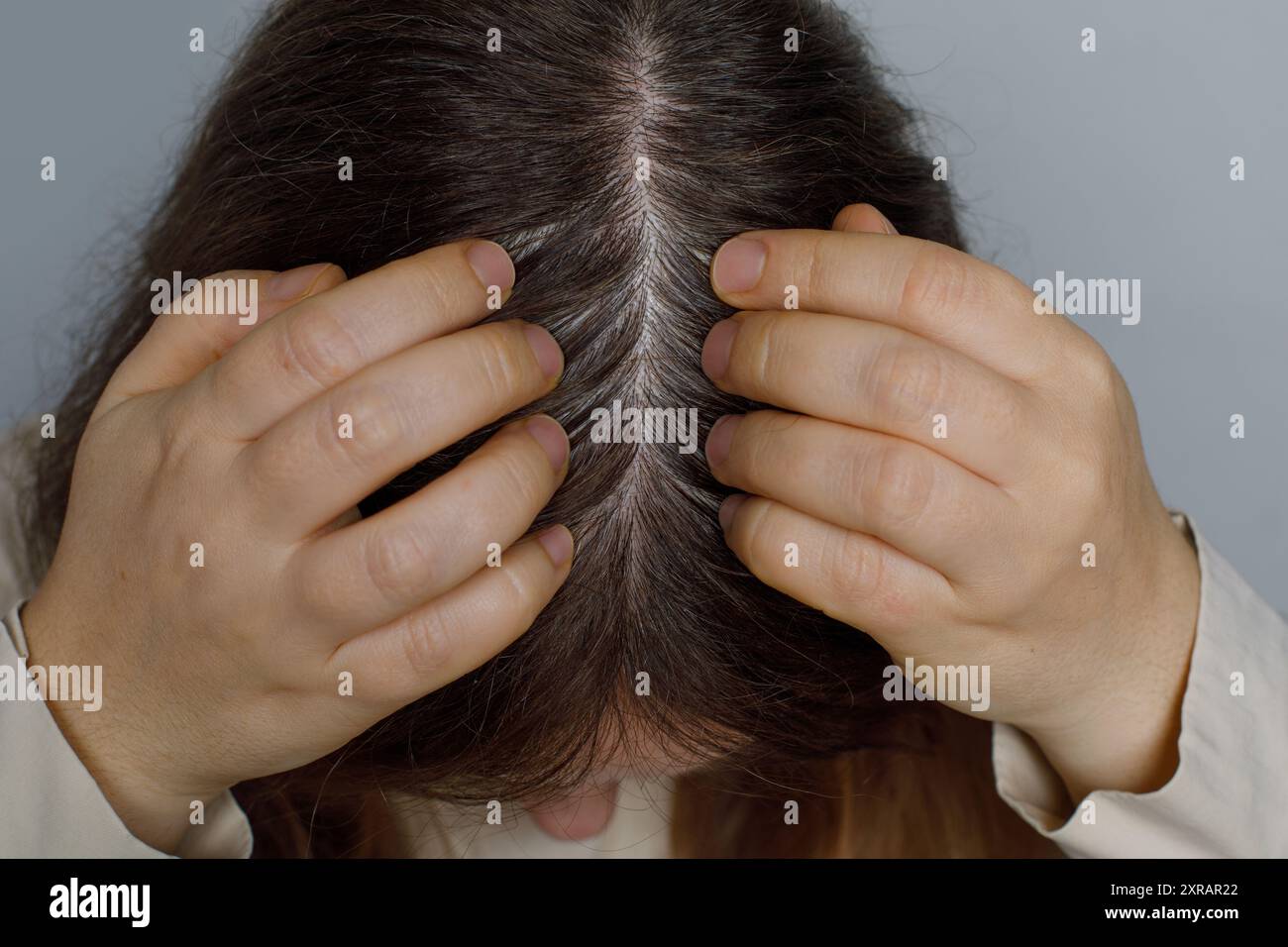 Female Hair loss and alopecia concept Stock Photo - Alamy