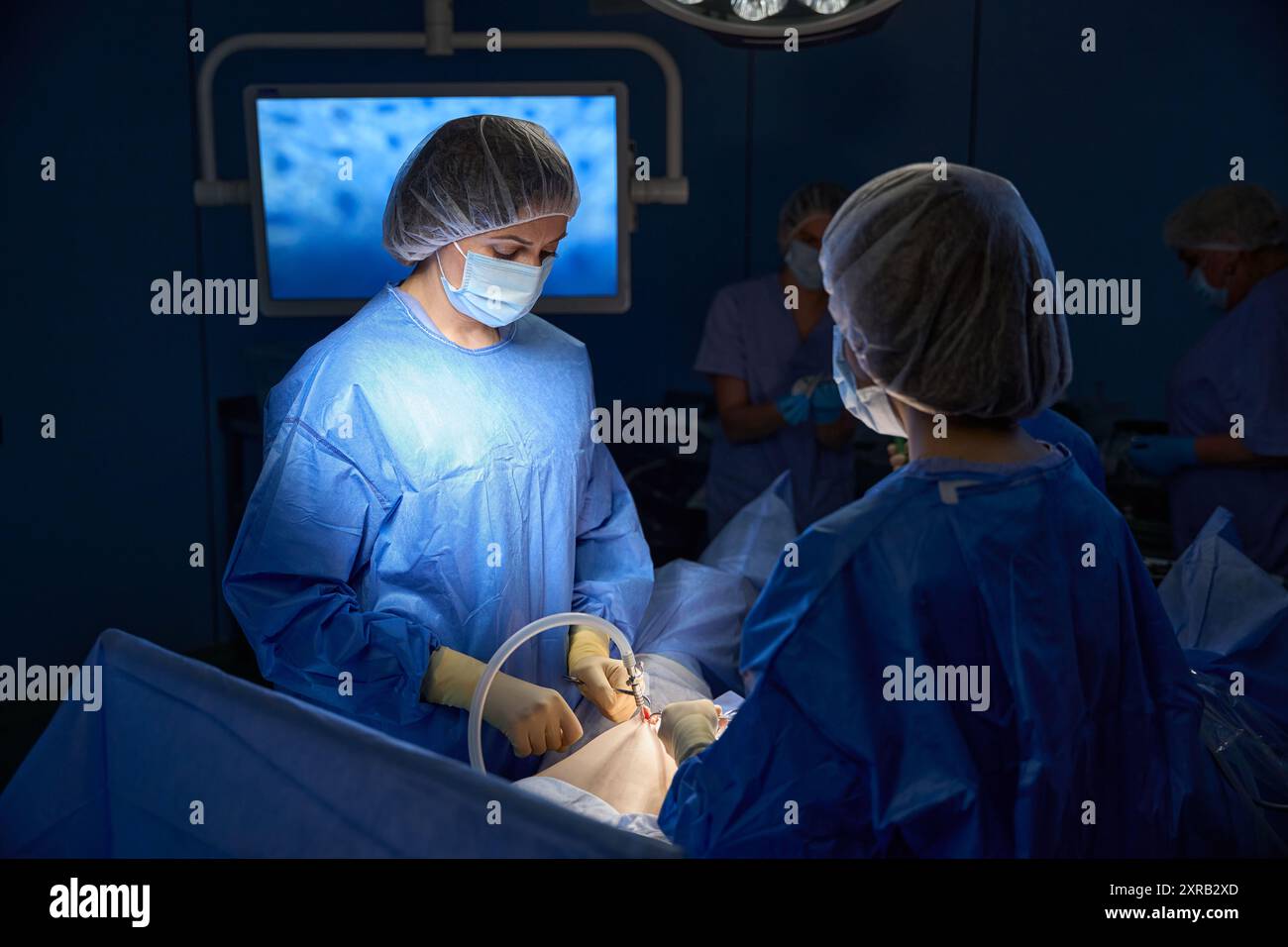 Team doctors performing laparoscopic hi-res stock photography and ...