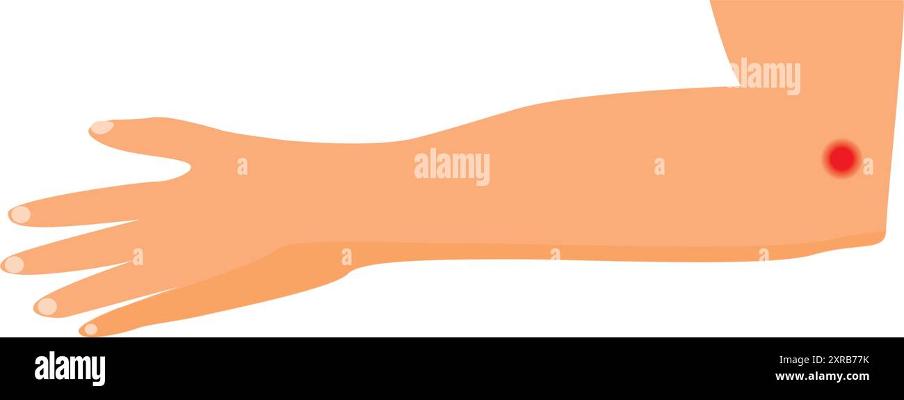 Elbow pain vector. Free space for text. Wallpaper. Copy space Stock ...