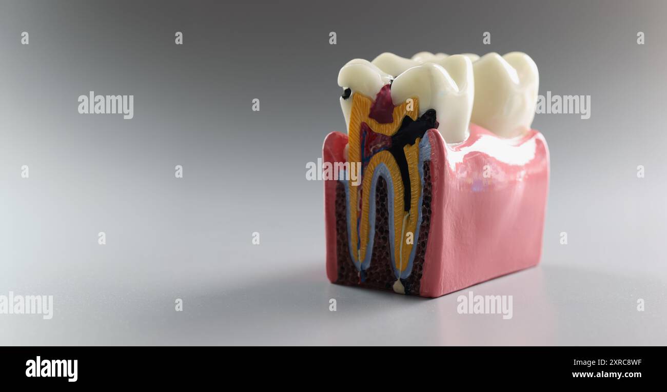 Teaching model of a tooth in cross section, close-up Stock Photo - Alamy