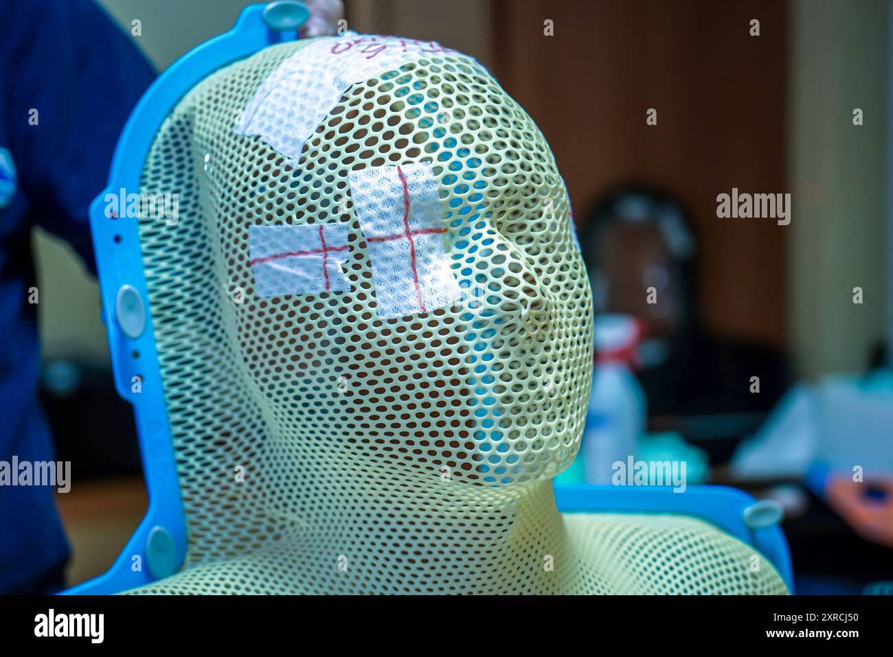 Patient In Mask For Whole Brain Radiotherapy Treatment Or Total Brain Radiotherapy To Target