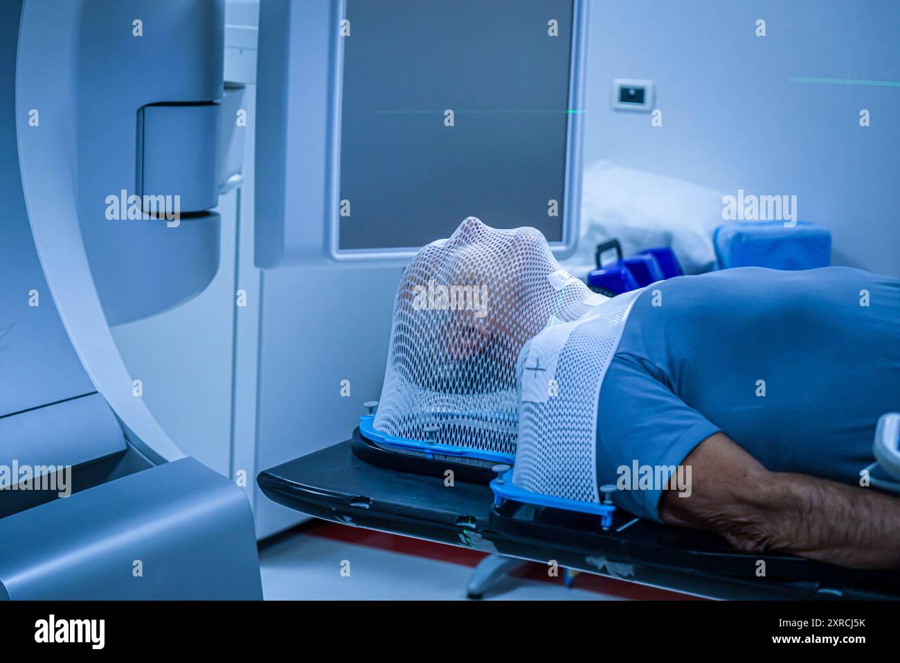 Patient in mask for whole brain radiotherapy treatment or total brain ...