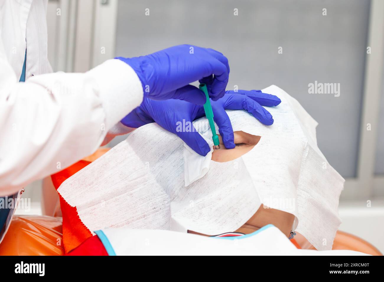 Skin lesion removal procedure. Dermatologist carrying out a removal of ...