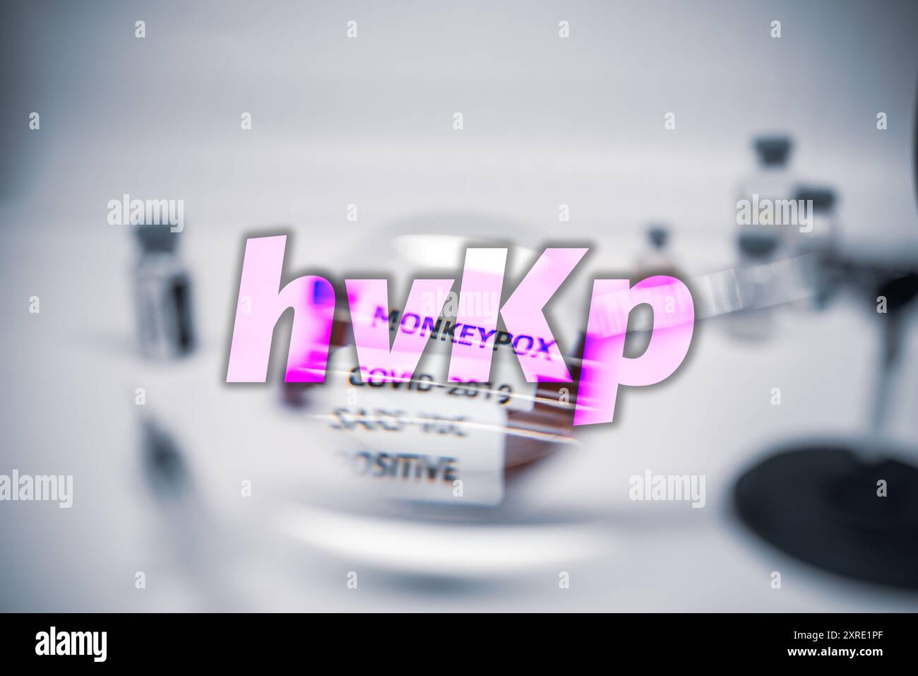 Hypervirulent klebsiella pneumoniae hi-res stock photography and images ...