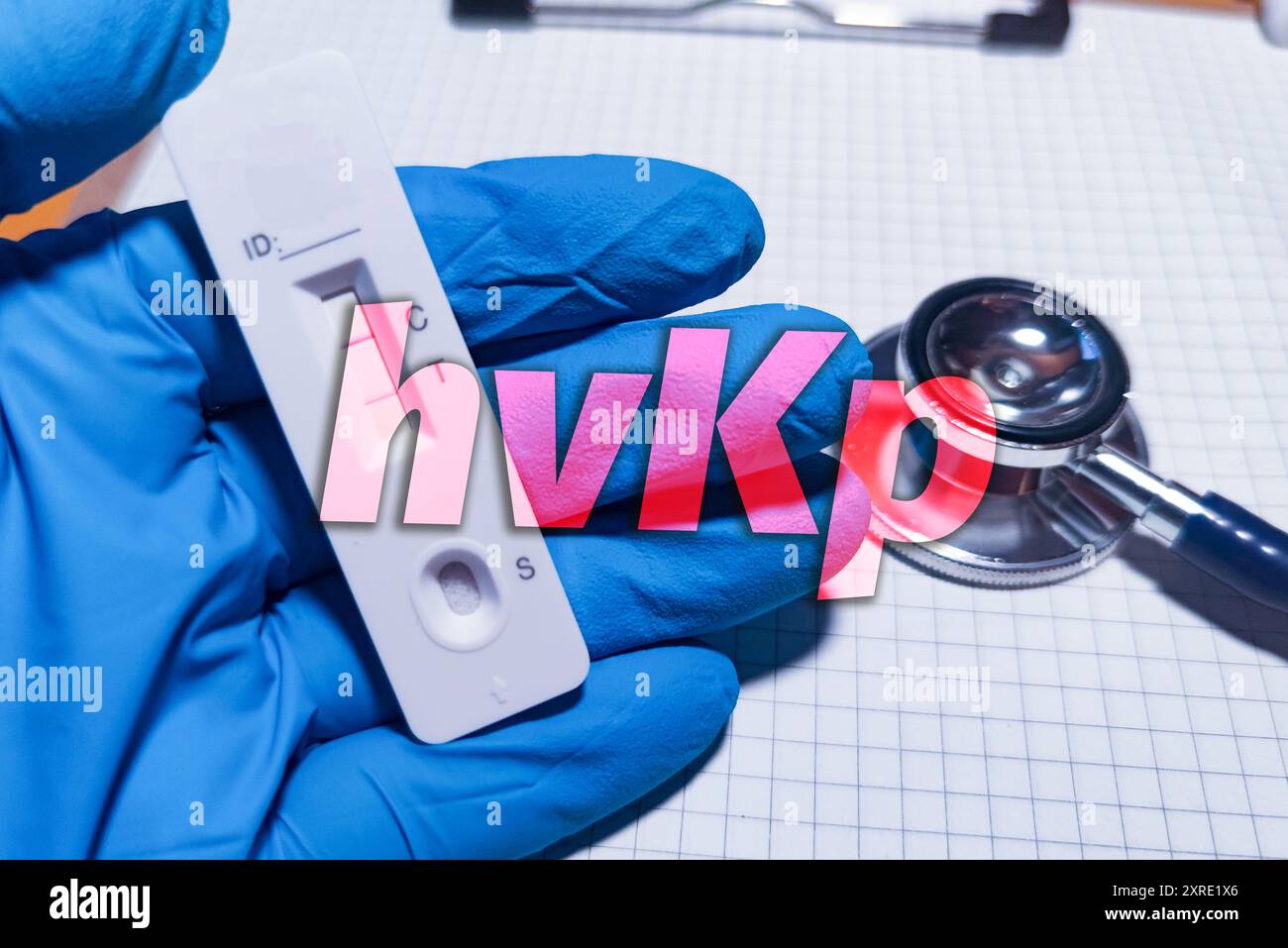 Klebsiella pneumoniae hi-res stock photography and images - Alamy