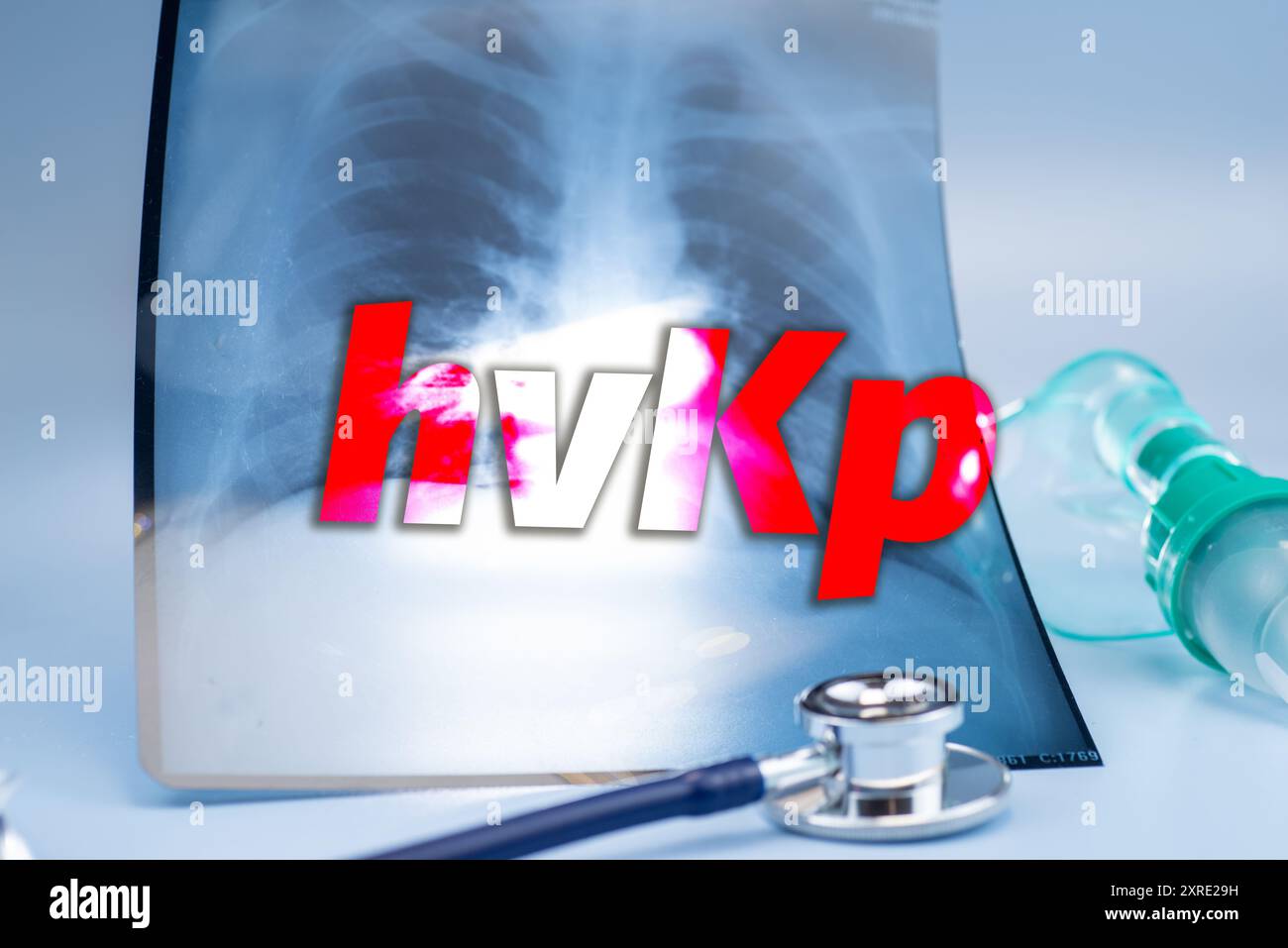 Hypervirulent K. pneumoniae (hvKp) is an evolving pathotype that is ...