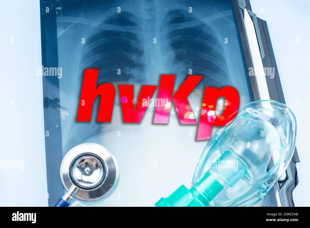 Bacteria klebsiella pneumoniae hi-res stock photography and images - Alamy