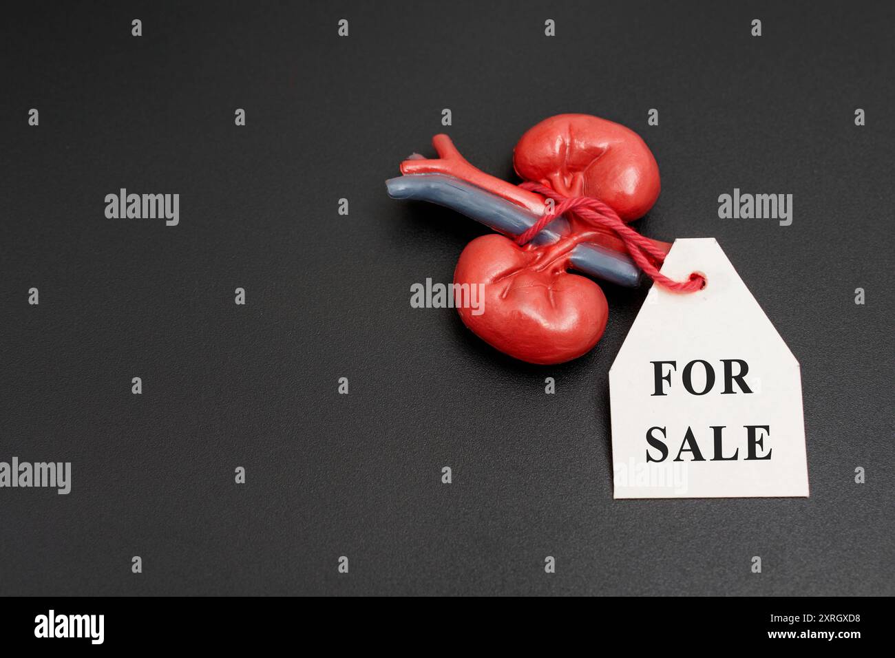 Plastic model of kidneys with a tag reading 'FOR SALE' on a dark ...