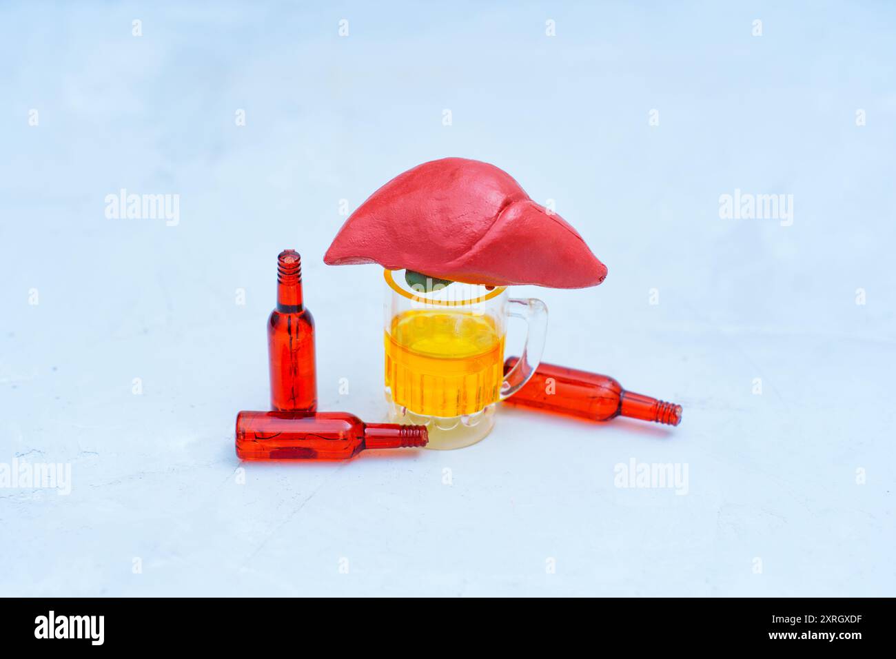 Anatomical model of the liver positioned atop a beer mug, accompanied ...