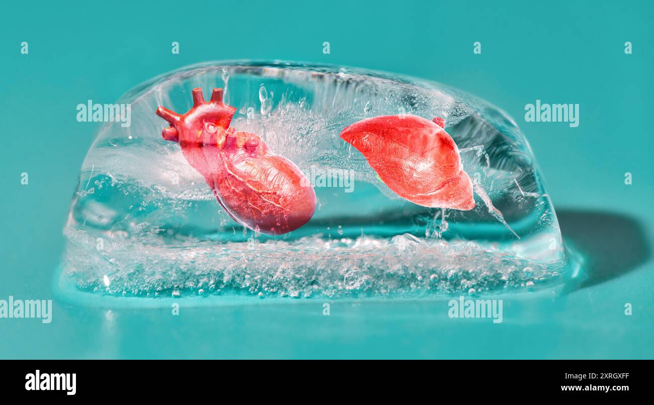 Liver transplant ice hi-res stock photography and images - Alamy