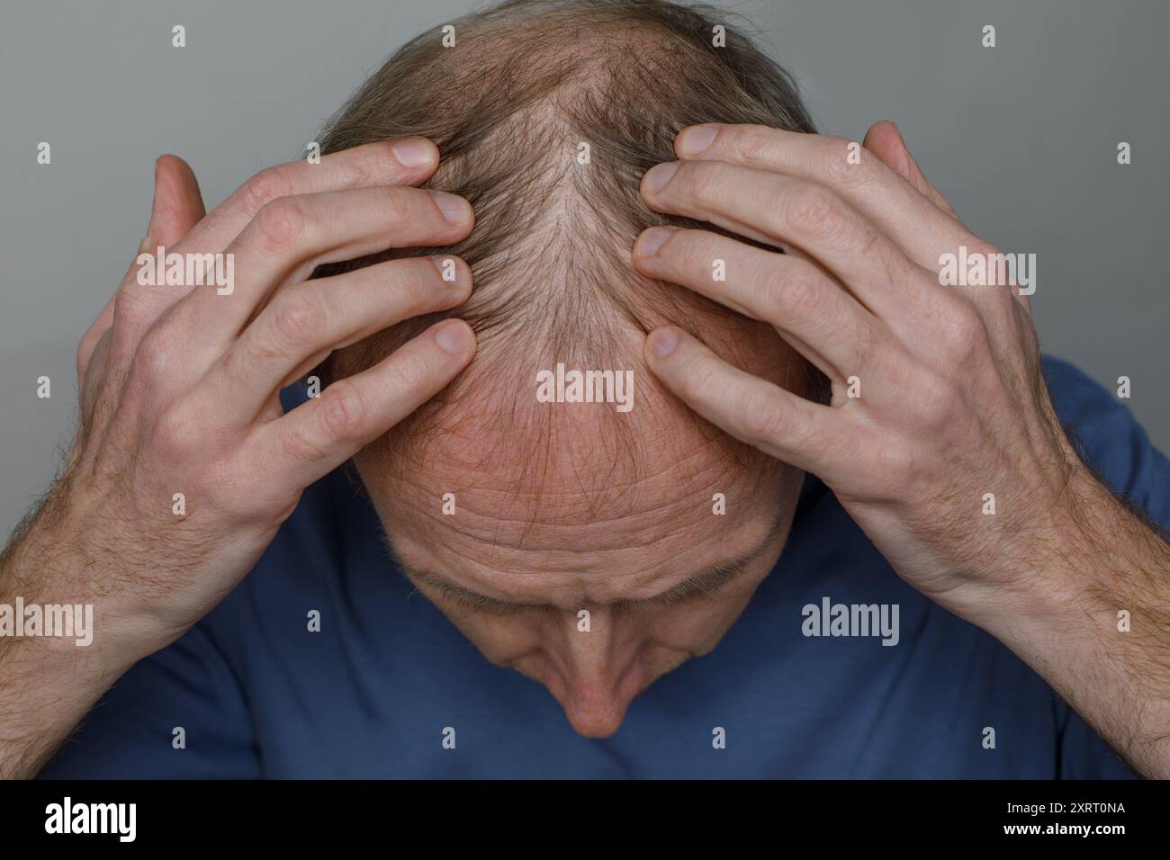 Human head top view hi-res stock photography and images - Alamy