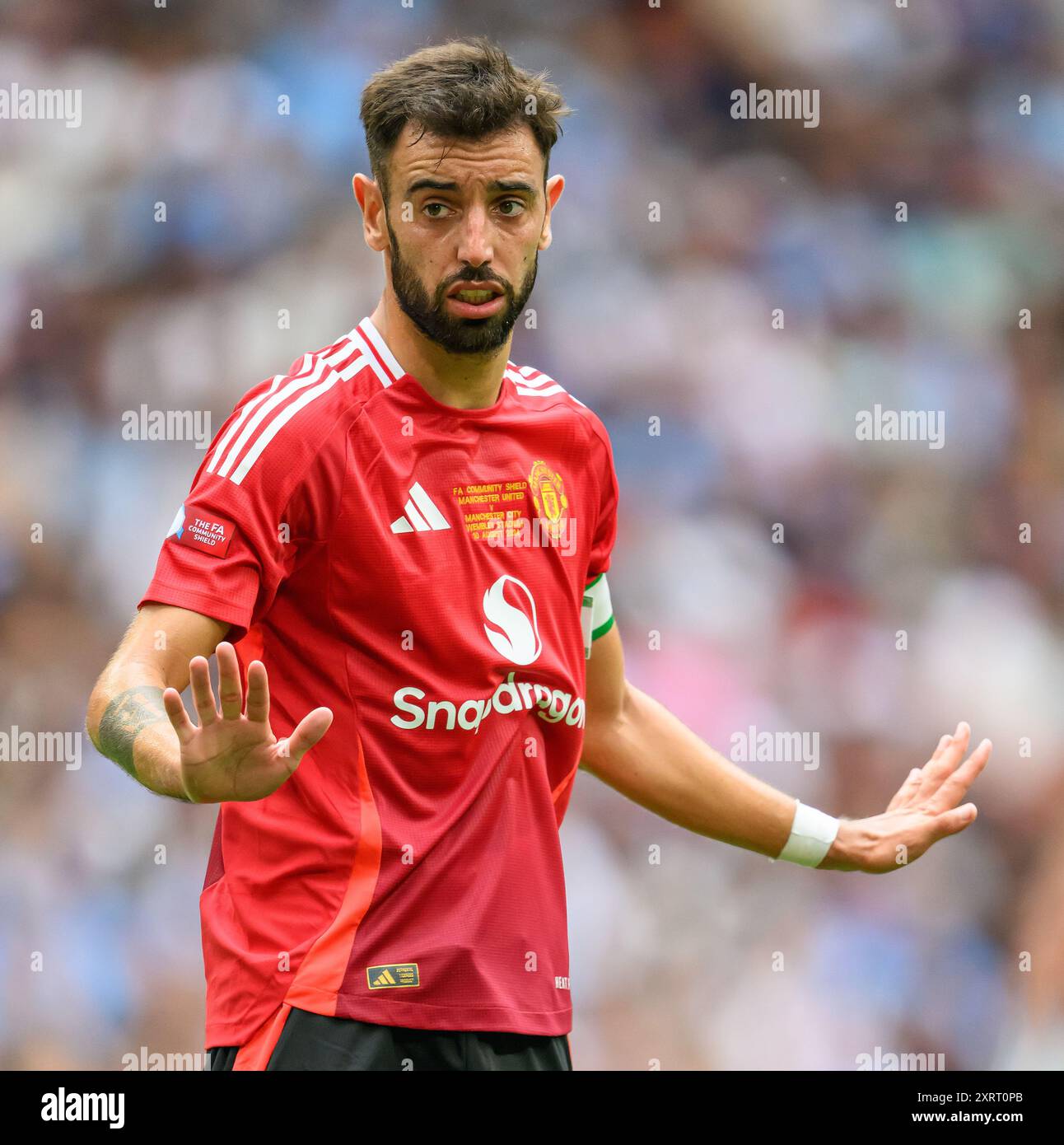 10 Aug 2024 - Manchester City v Manchester United - Community Shield ...