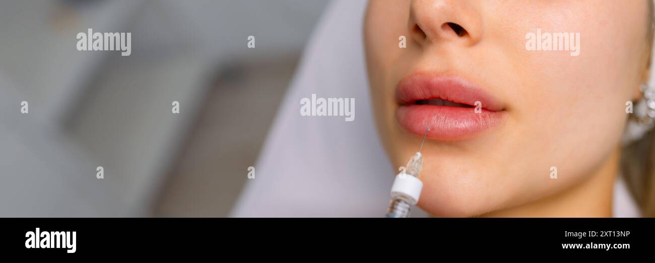 Injection procedure for lip augmentation, close-up. The cosmetologist ...