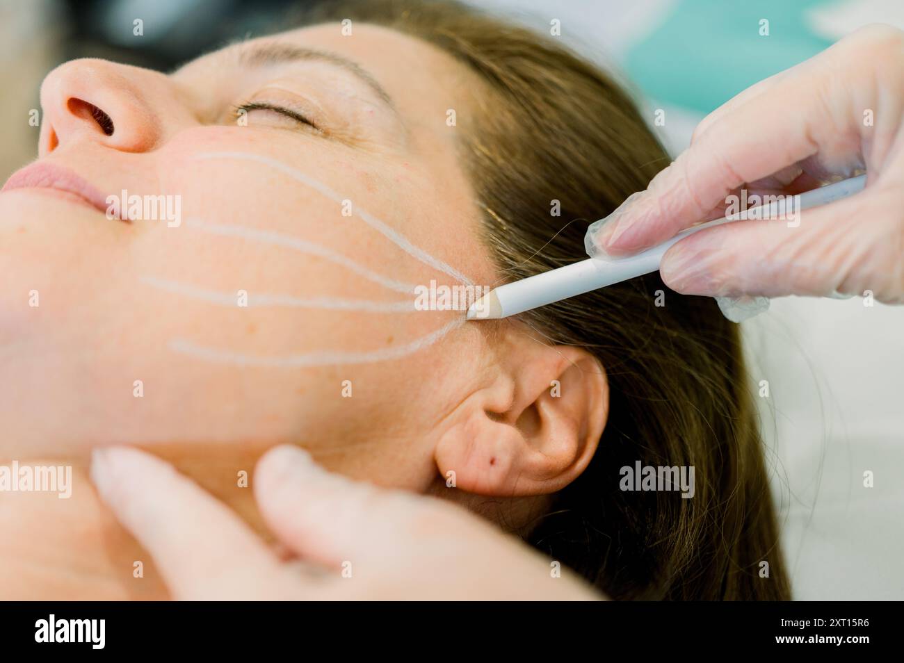 An aesthetician marks key points on a woman's face with a white pencil ...