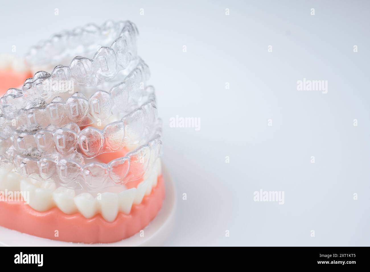 Many dental orthodontic teeth hi-res stock photography and images - Alamy