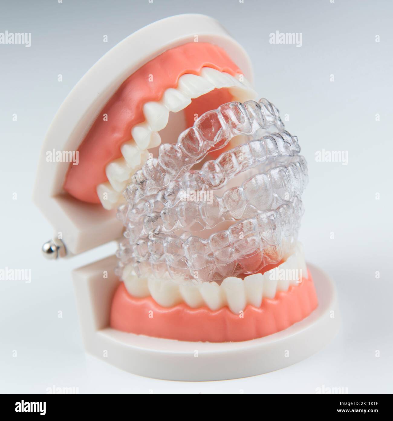 Close-up. Many clear aligners are placed over the teeth of an ...