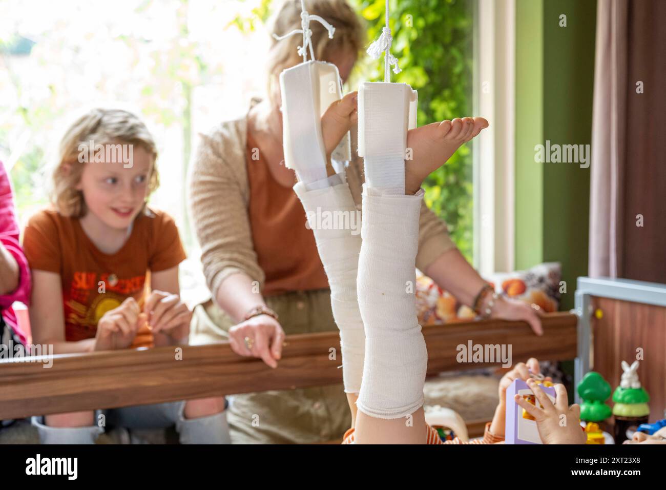 Mother attending her child who has broken their legs. Laying in bed ...
