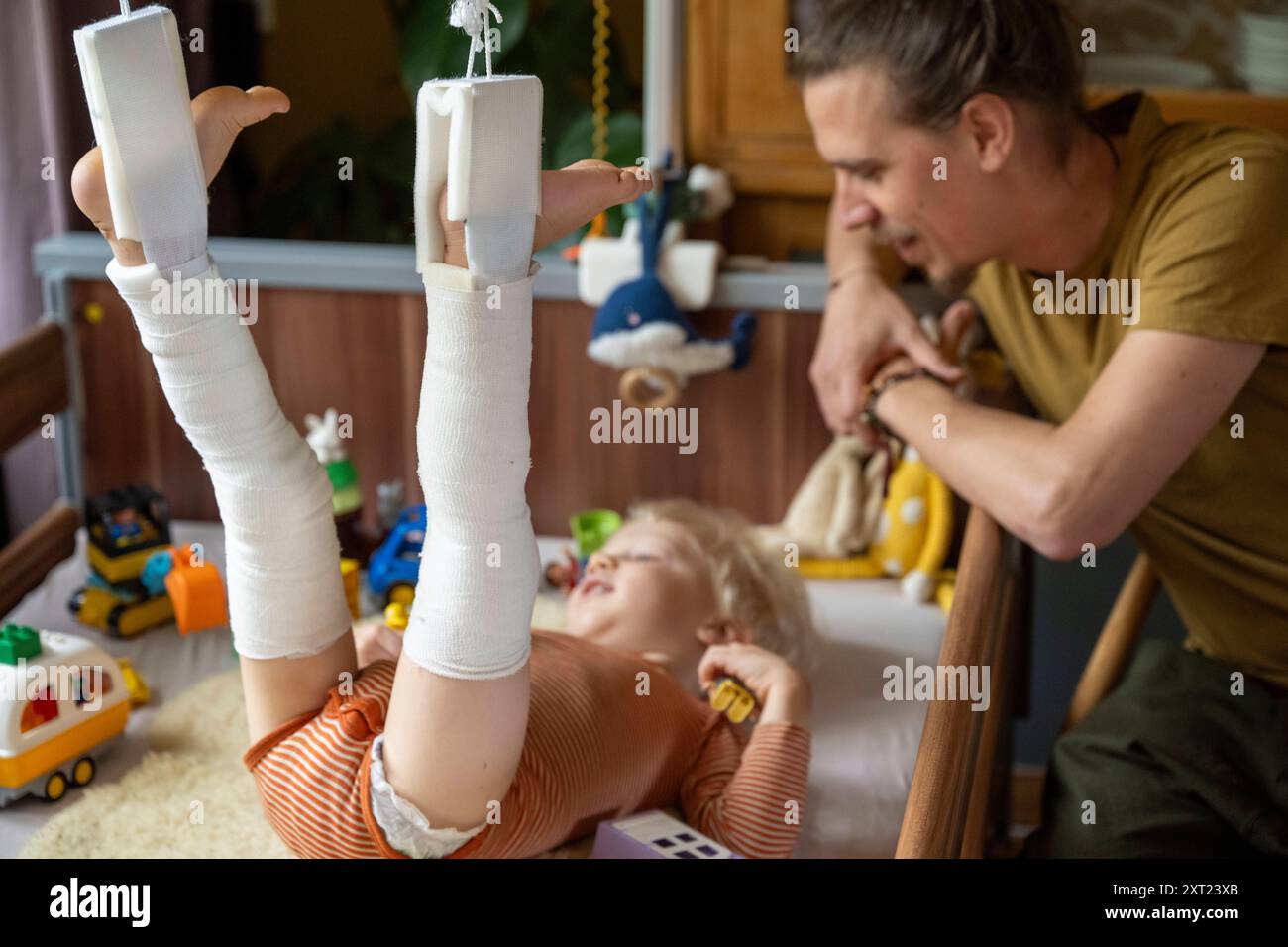A child lies on their back playing with bandaged legs in the air while ...