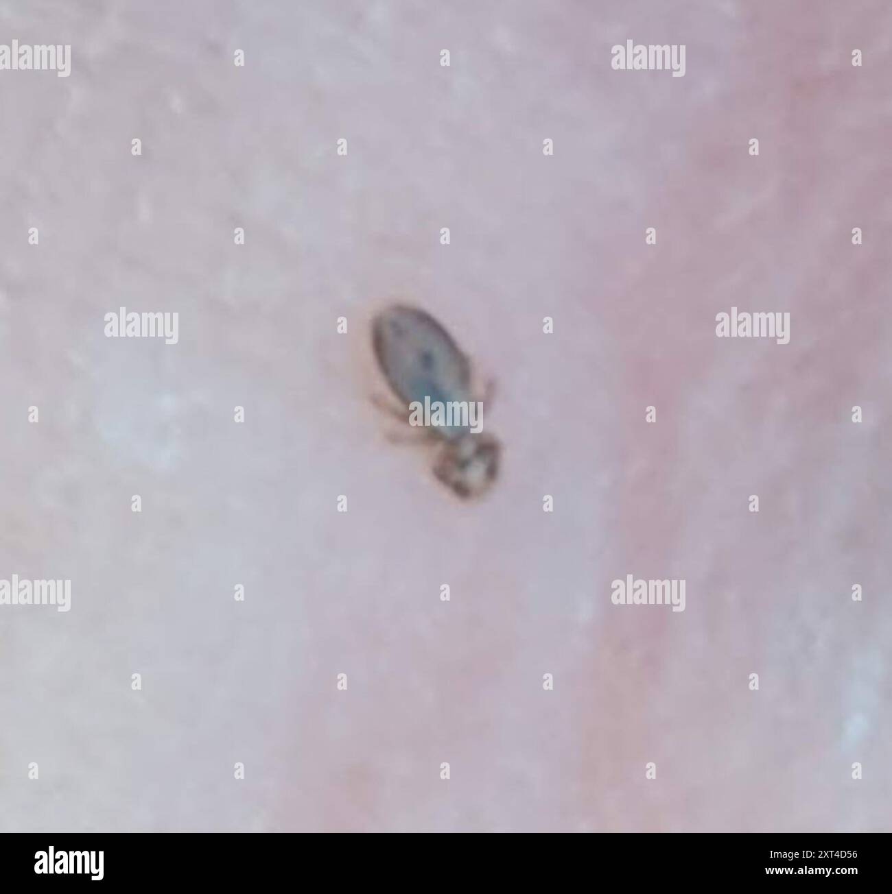 chicken body lice (Menoponidae) Insecta Stock Photo - Alamy