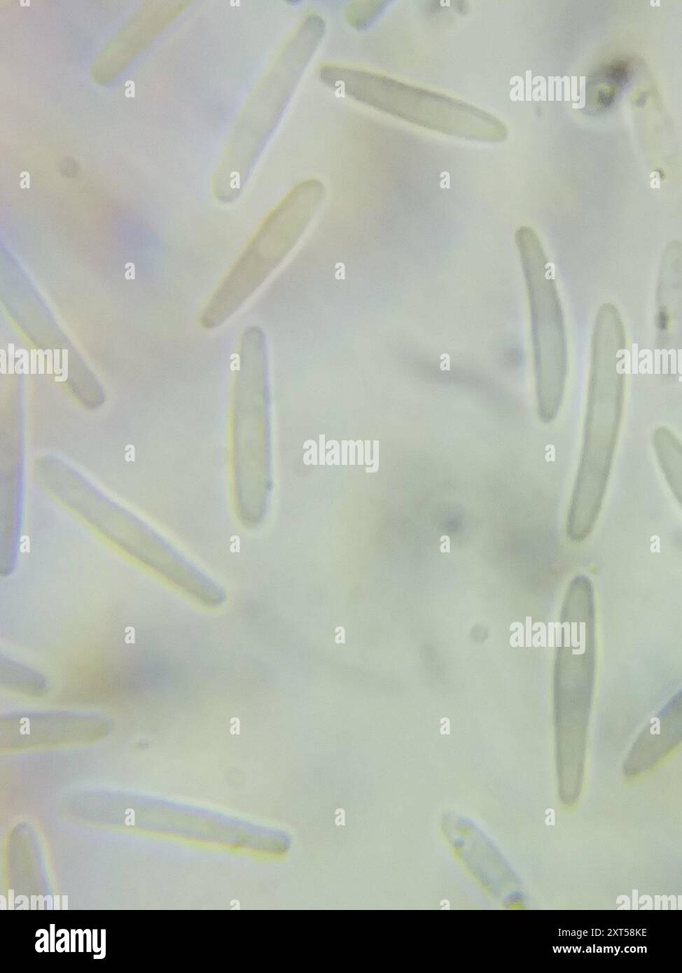 swamp beacon (Mitrula elegans) Fungi Stock Photo - Alamy