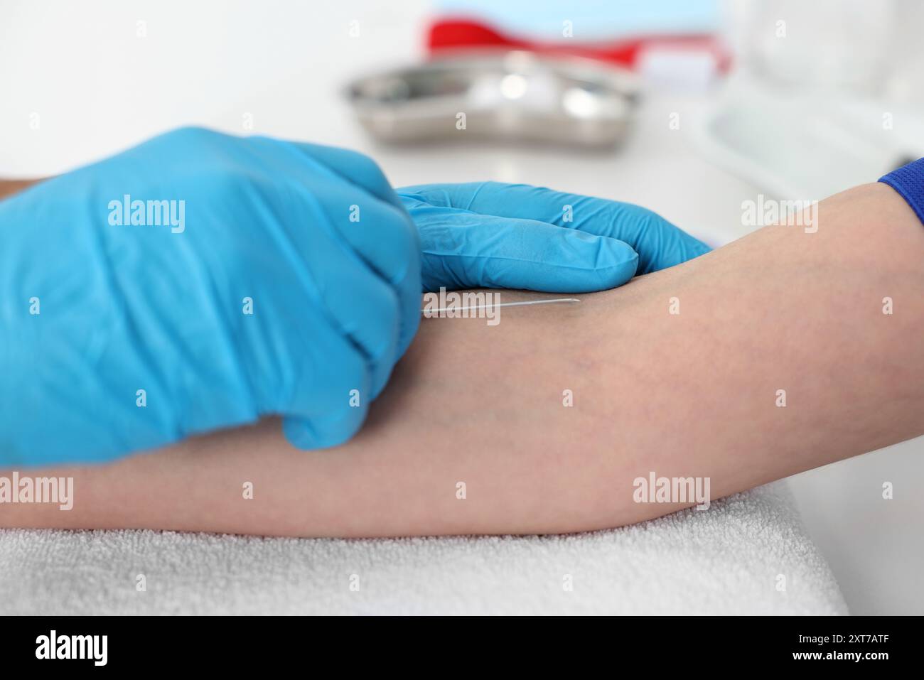 Nurse inputting catheter for IV drip in patient hand, closeup Stock ...