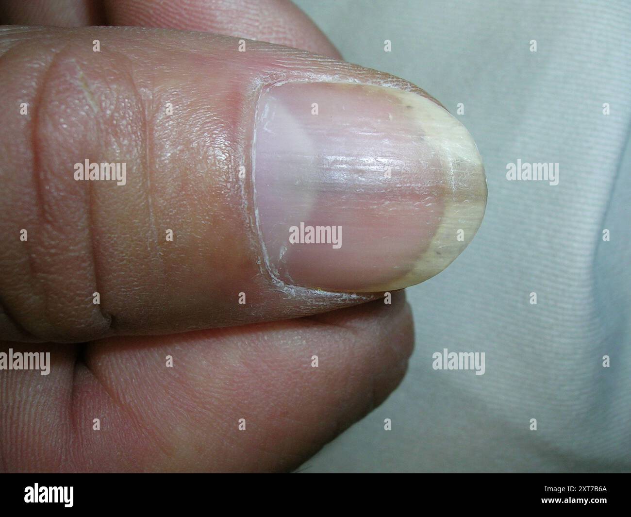 Client restrictions apply, please speak to your account manager for ...