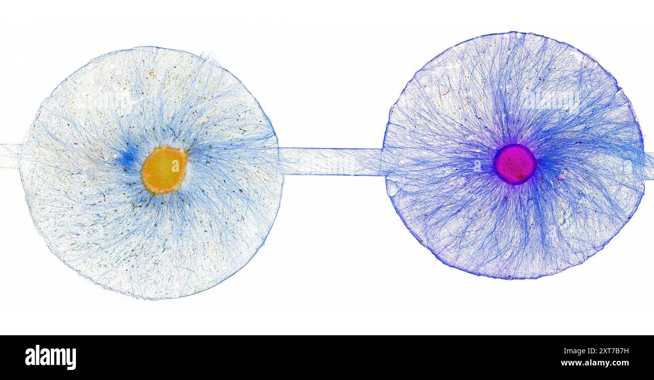 Confocal light micrograph of a synaptic conjugation between three ...