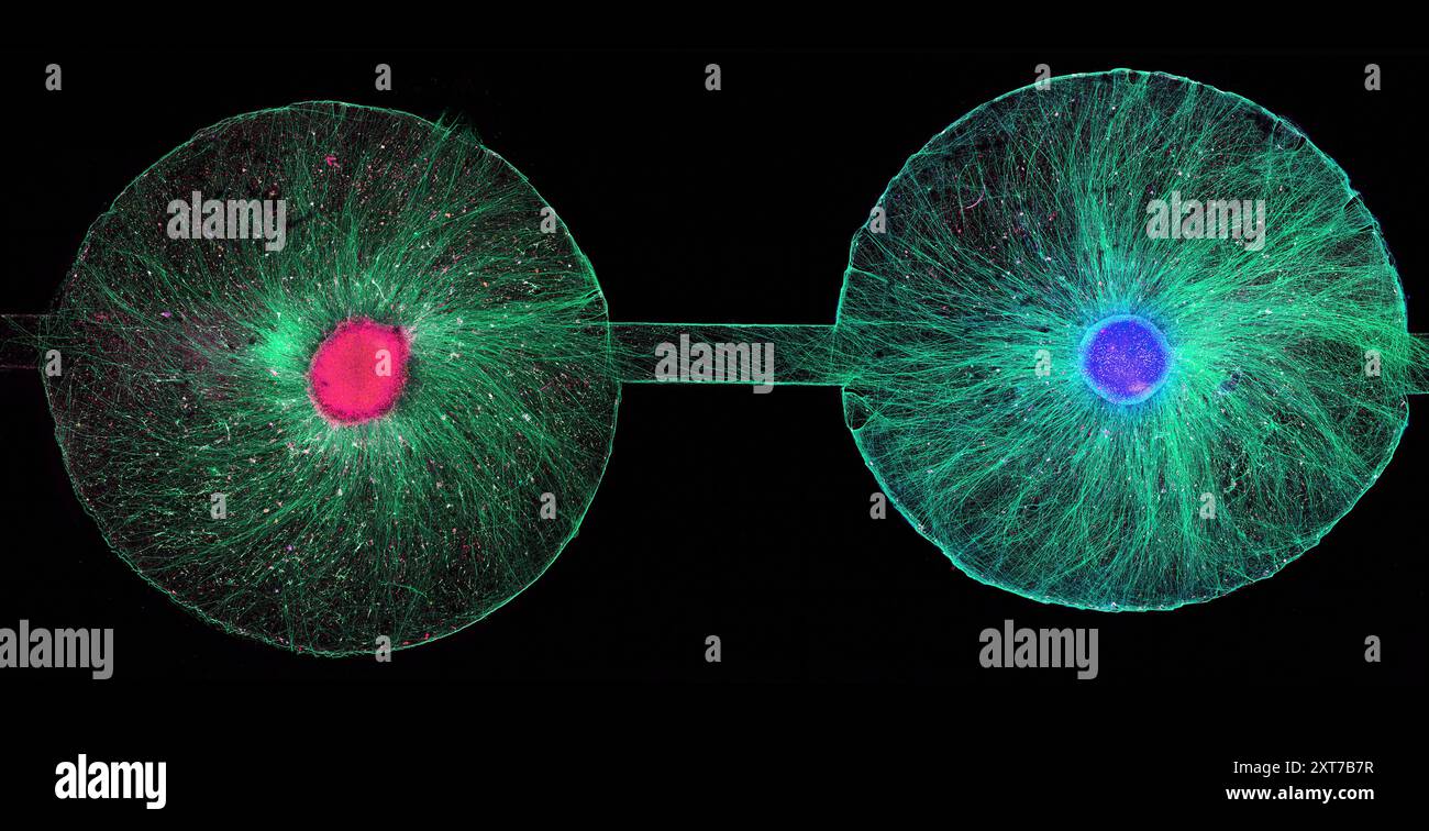 Confocal light micrograph of a synaptic conjugation between three ...
