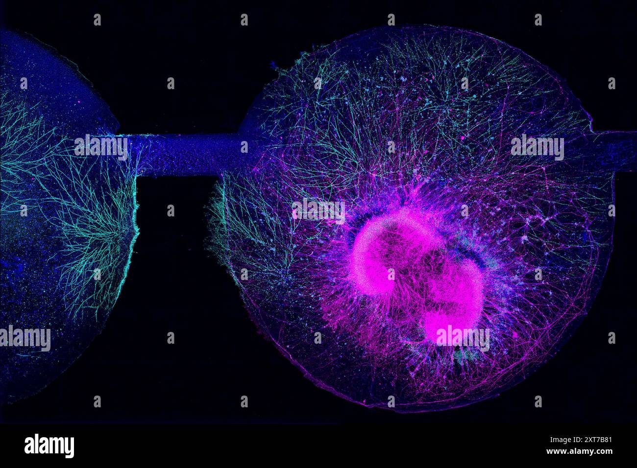 Confocal light micrograph of a synaptic conjugation between three ...